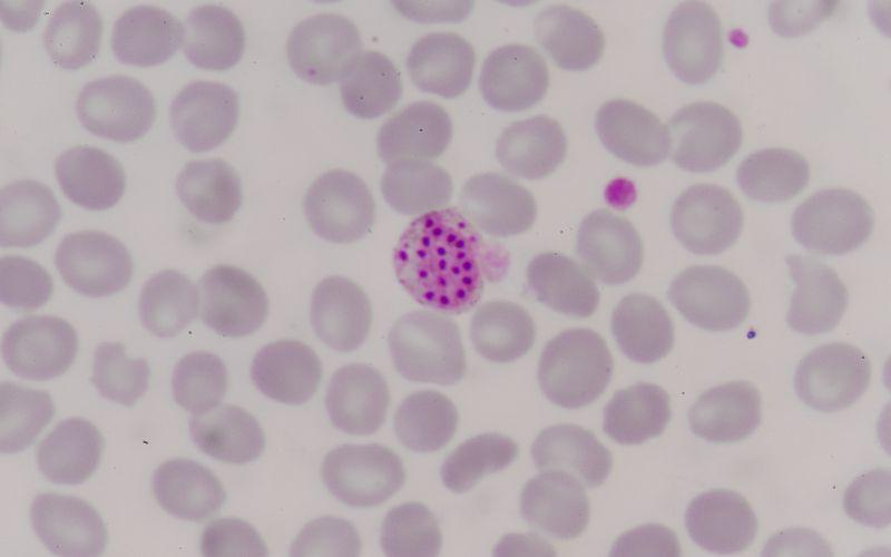 Microcitosis: qué es, causas, síntomas, tratamiento