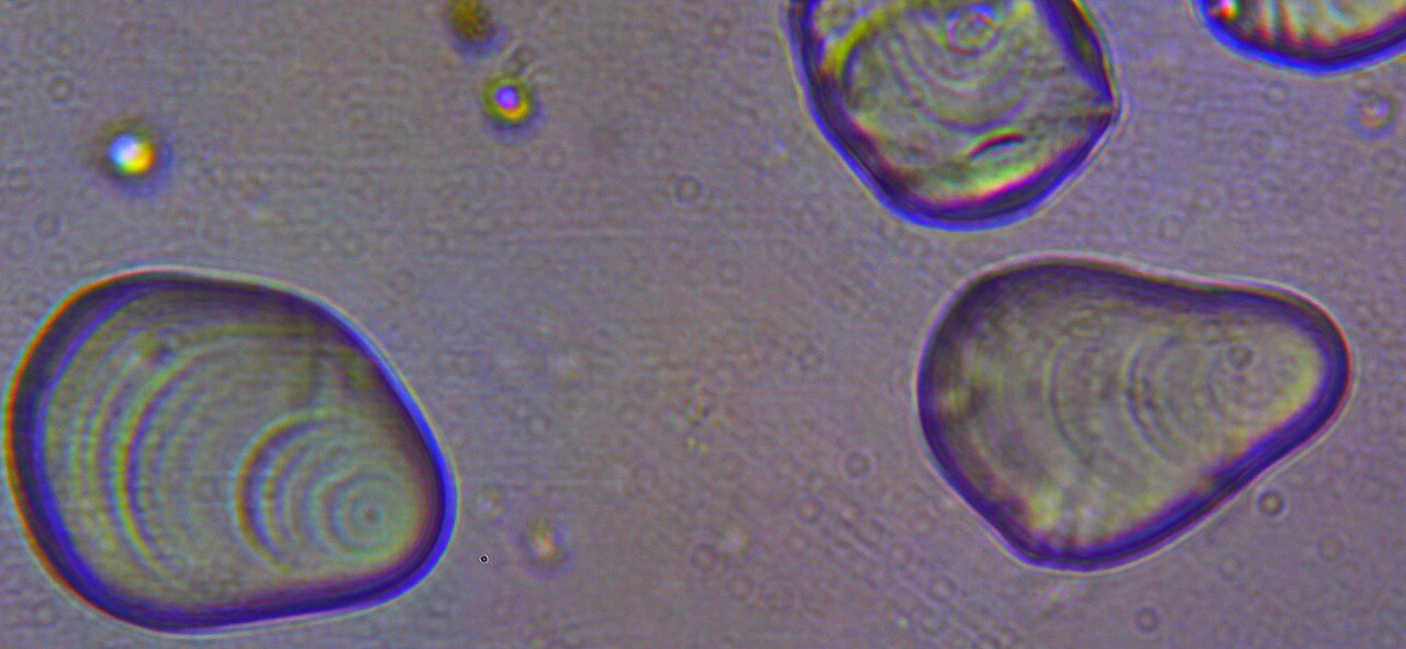Leucoplastos: características, tipos y funciones