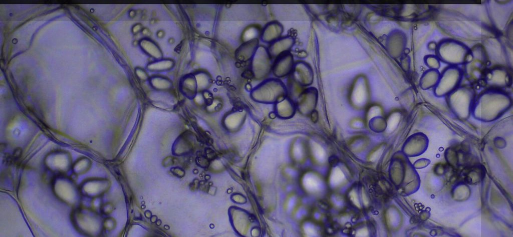 Leucoplastos: características, tipos y funciones