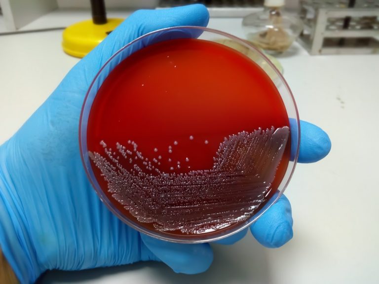 Enterobacterias Concepto Características Clasificación Ejemplos