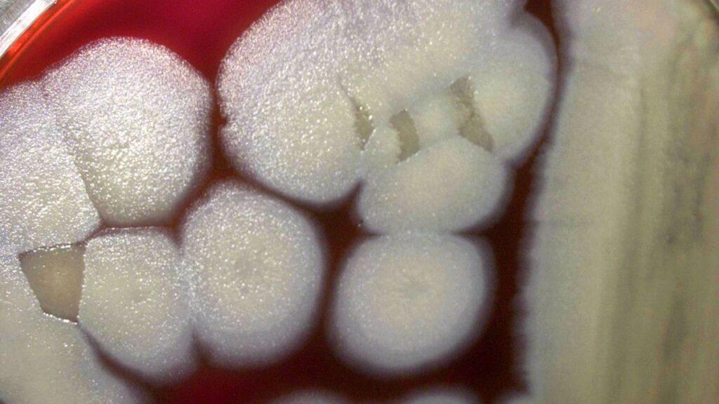 Bacillus thuringiensis: qué es, taxonomía, morfología, características