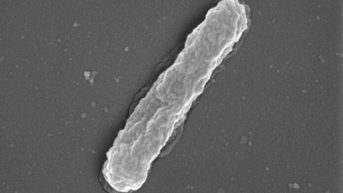Morganella morganii: qué es, características, ciclo vital, enfermedades