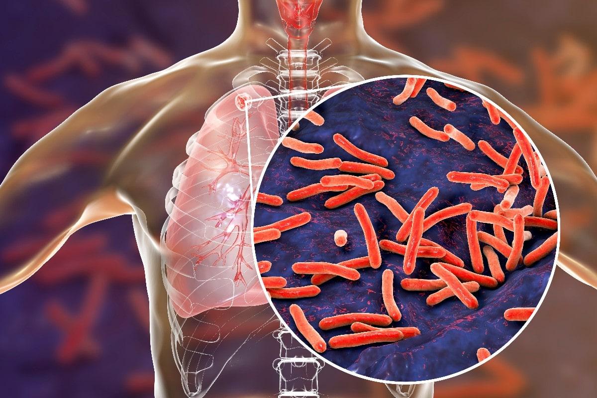 Mycobacterium tuberculosis: qué es, características, morfología, cultivo