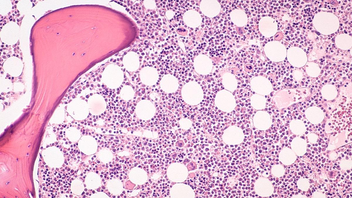 Tejido Hematopoyético Qué Es Características Histología Tipos