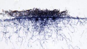 Actinomyces israelii: qué es, características, morfología, patogenia