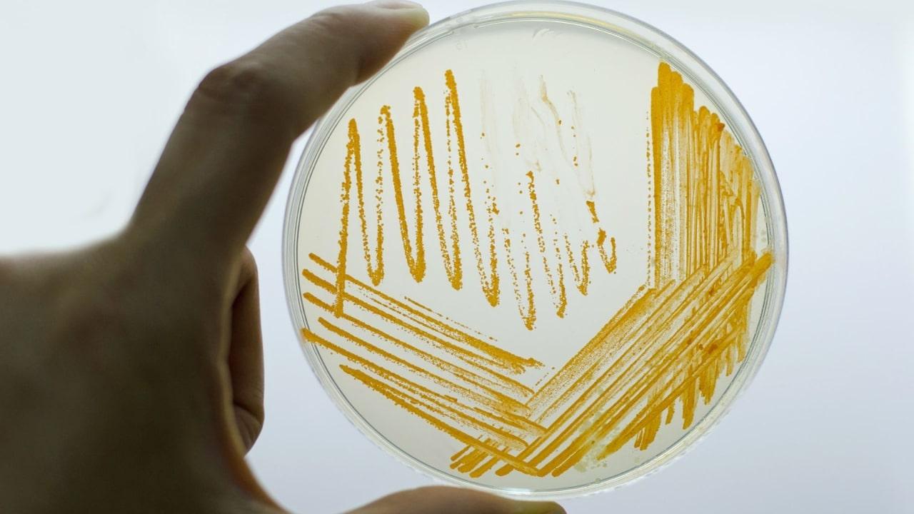 Actinomyces: qué es, características, morfología, patogenia