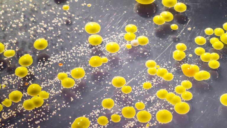 Micrococcus luteus: qué es, morfología, características, enfermedades