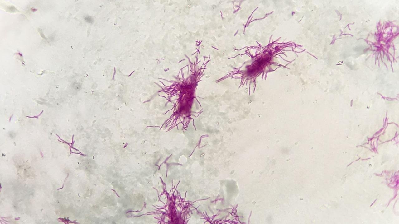 Nocardia: qué es, características, morfología, cultivo, patogenia