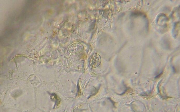 Quitridiomicetos: qué son, características, ciclo vital, nutrición