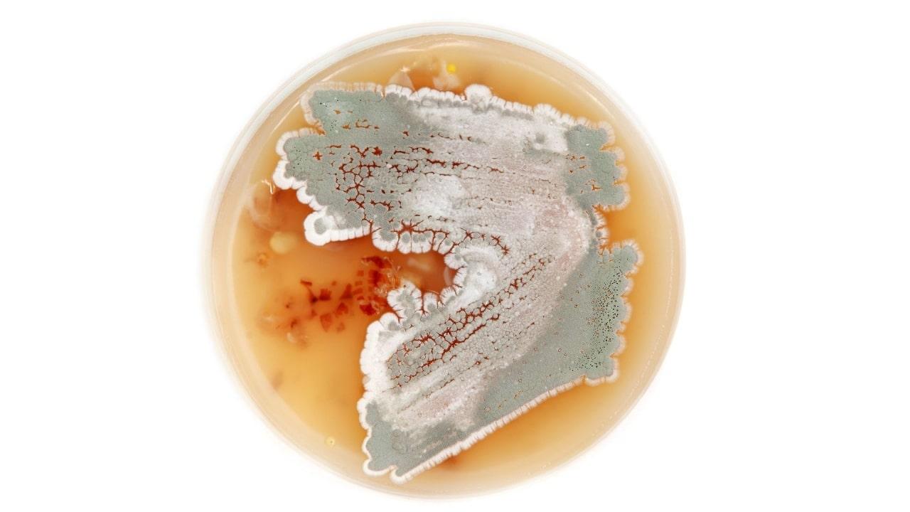 Streptomyces: qué es, características, morfología, usos, patogenia