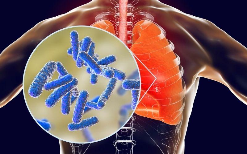 Bordetella pertussis: qué es, características, morfología, patogenia