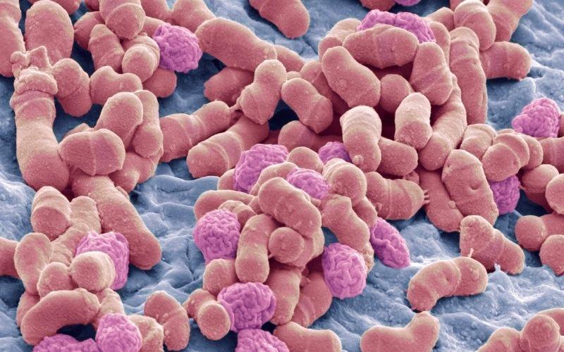 Malassezia furfur: qué es, características, patologías, tratamiento