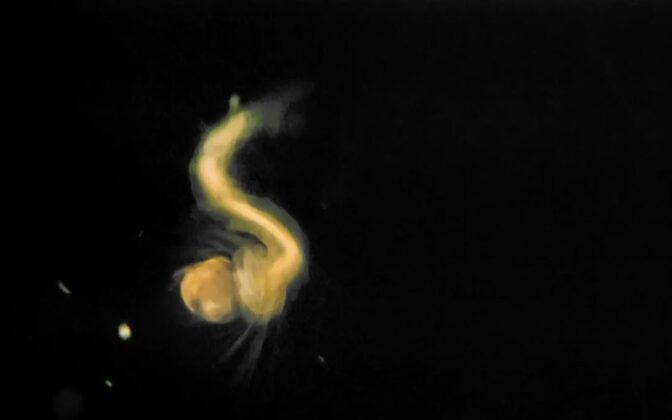 Plasmodium vivax: qué es, morfología, ciclo de vida, síntomas, tratamiento