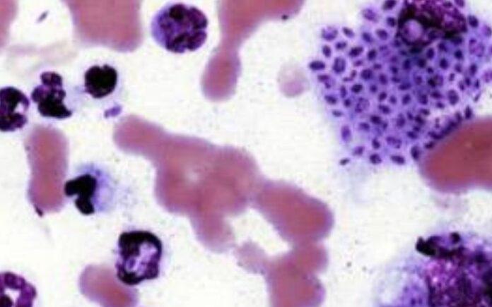 Sporothrix schenkii: qué es, características, morfología, patogenia