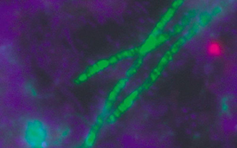 Quimiótrofos: qué son, características, clasificación y tipos