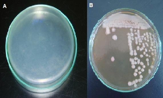 Agar Sabouraud: qué es, fundamento, preparación, usos