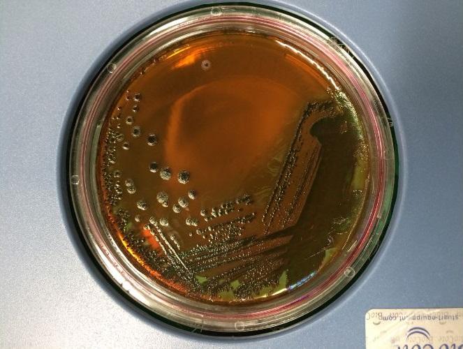 Agar EMB: qué es, fundamento, preparación y usos