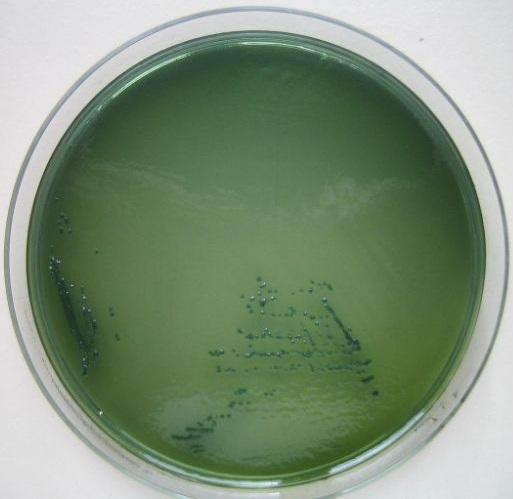 Agar TCBS: qué es, fundamento, preparación, usos
