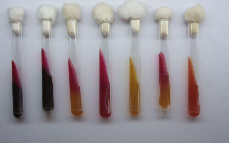 Prueba Tsi Microbiología