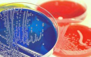 Proteus mirabilis: qué es, características, morfología, contagio, síntomas