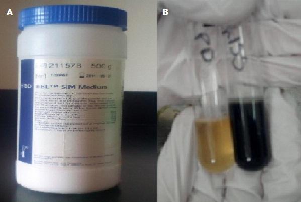 Medio SIM: qué es, fundamento, preparación y usos