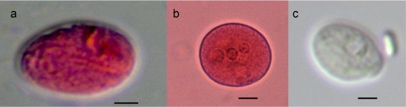 Chilomastix mesnili: qué es, características, morfología, ciclo vital