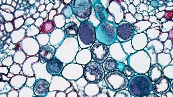 Parénquima: características, funciones, animal y vegetal