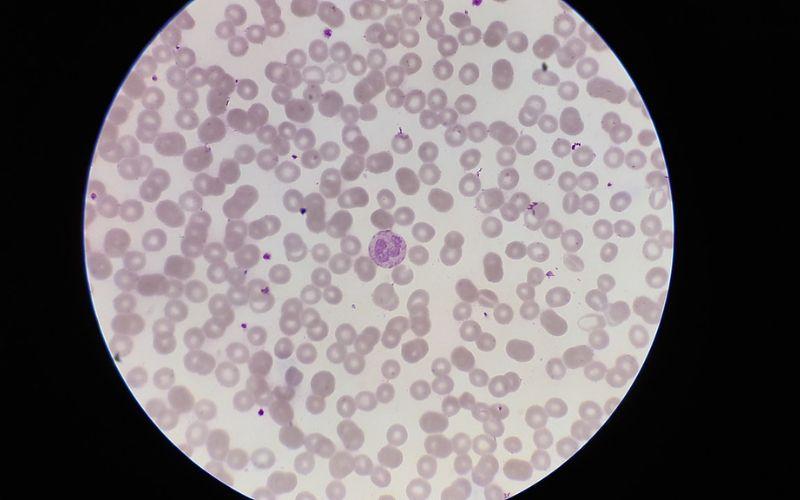 Buffer de fosfatos: qué es, preparación, fundamento y usos