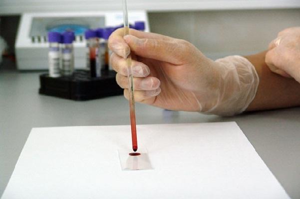 Frotis Sanguíneo Características Tipos Técnicas E Histología