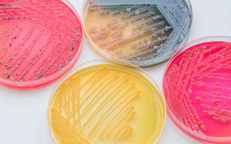 Medios de cultivo selectivos: qué son, fundamento, sólidos y líquidos