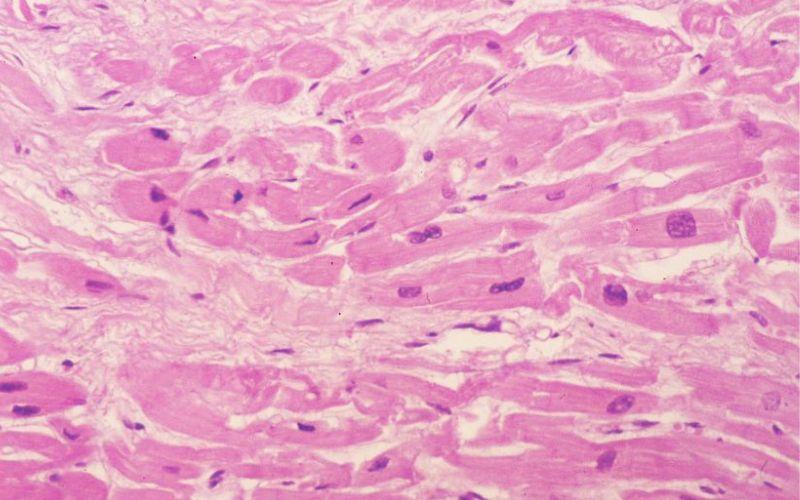 Picnosis: qué es, características