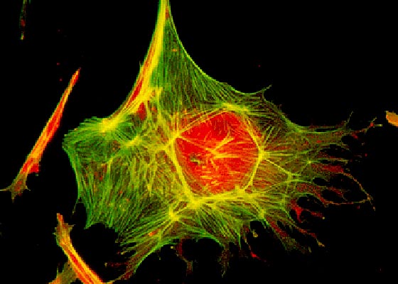 Vimentina: qué es, características, estructura, función y usos