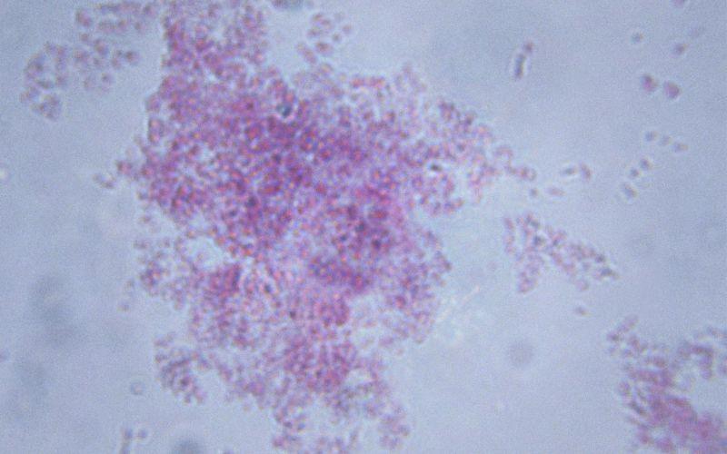 Exemplos De Bacterias Anaerobicas