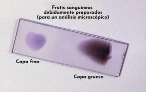 Frotis sanguíneo: qué es, características, tipos, técnicas, histología