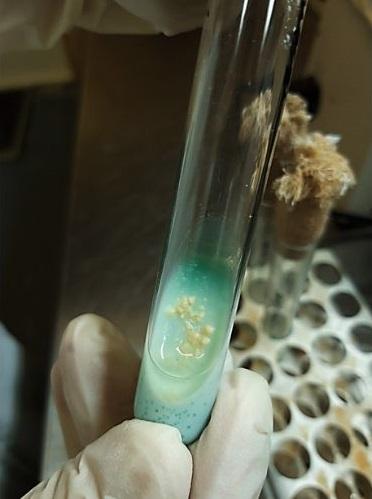 Medio Löwenstein-Jensen: qué es, fundamento, preparación y usos