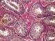 Célula de Sertoli: características, histología y funciones