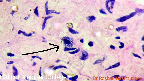 Mastocitos: origen y formación, características y funciones