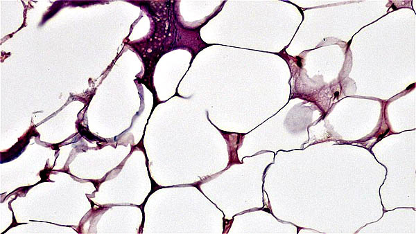 Tejido conectivo laxo: qué es, características, histología, tipos ...
