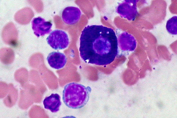 Mastocitos: qué son, origen y formación, características, funciones