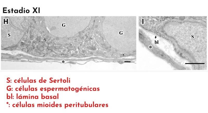 Células de Sertoli: qué son, caracteristicas, histología y funciones