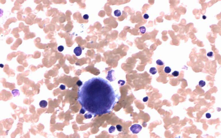 Megacariocitos: qué son, características, funciones, formación