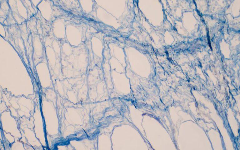 Tejido conectivo laxo: qué es, características, histología, tipos ...