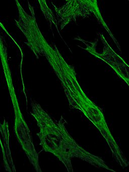 Filamentos intermedios: qué son, estructura, tipos, funciones