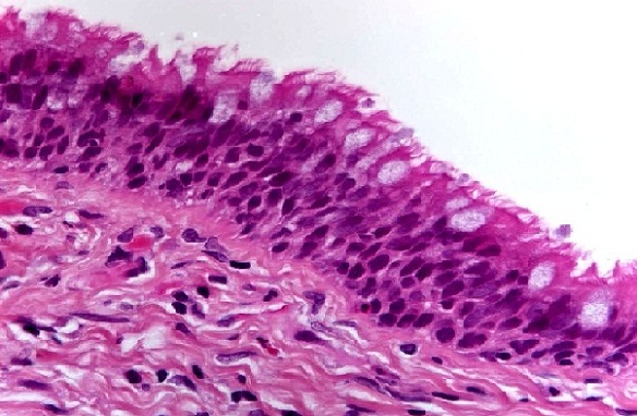 Tinción de hematoxilina-eosina: características, usos, técnicas