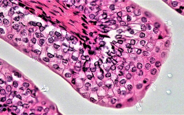 Urotelio: qué es, características, histología, funciones