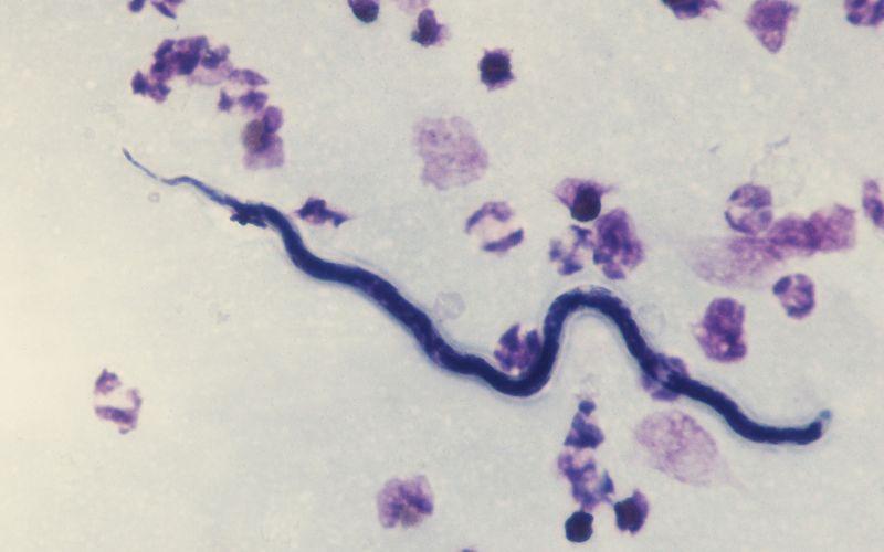 Loa loa: qué es, características, ciclo biológico, tratamiento