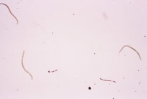 Onchocerca volvulus: características, morfología, enfermedades