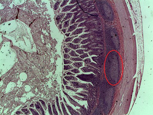 Placas de Peyer: características, funciones, histología