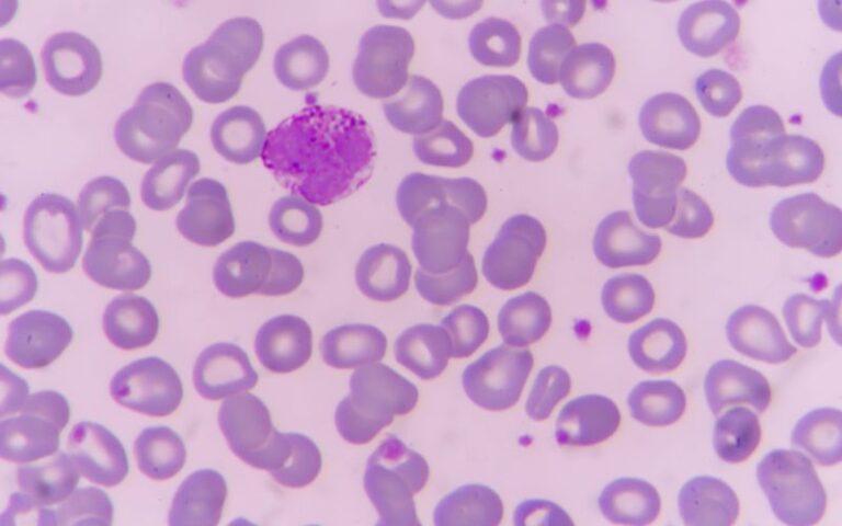 Basófilos: qué son, características, morfología, funciones