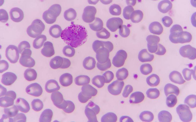 Basófilos: qué son, características, morfología, funciones